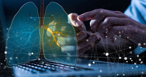 Lungenkrebsscreening Myosteatose Im Low Dose Ct Zeigt Erhöhtes