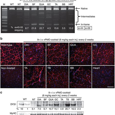 Immunohistochemistry Of Dystrophin Associated Proteins Accompanied