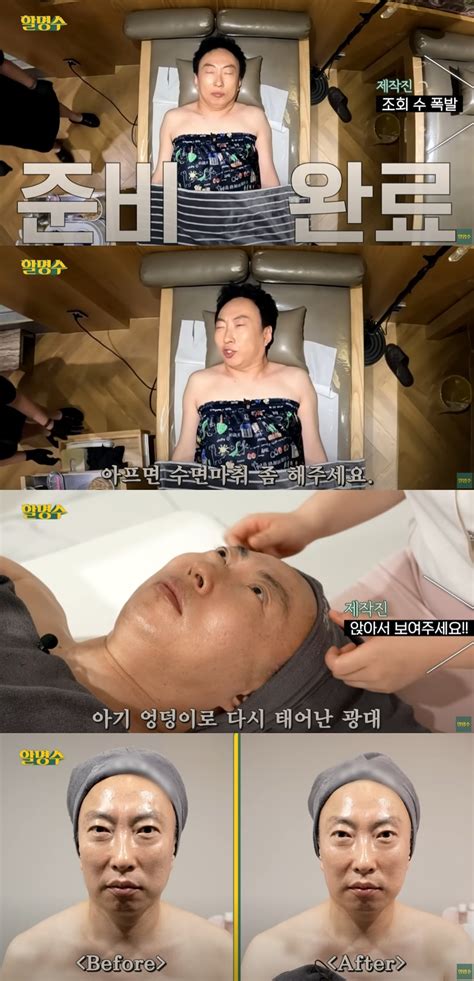 박명수 생애 첫 왁싱경락 도전 아프면 수면 마취 해달라 소셜in