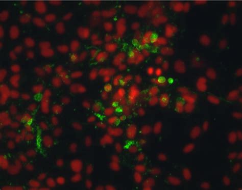 Figure 3 Eafp