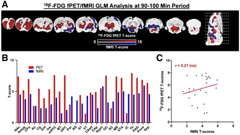 Neurovascular Uncoupling Multimodal Imaging Delineates The Acute Effects Of 3 4