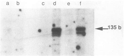 Primer Extension Analysis Rna Was Extracted As Previously Described