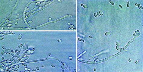 Candida Pseudohyphae Morphogenic Plasticity The Pathogenic Attribute
