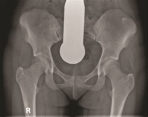 Case 5