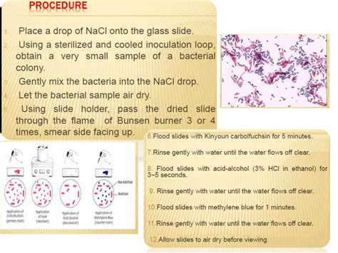 Staining Techniques Ppt