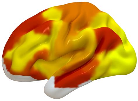 Cortical Atlas Parcellations Mni Space Lead Dbs
