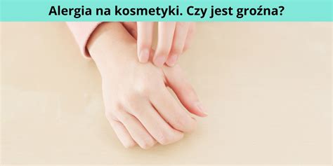 Alergia Na Kosmetyki Przyczyny I Objawy Uczulenia