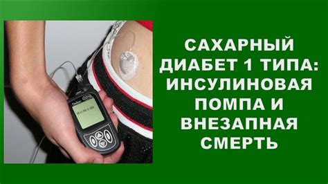 Помпа Сахарный Диабет Цена — Buy-artox.ru