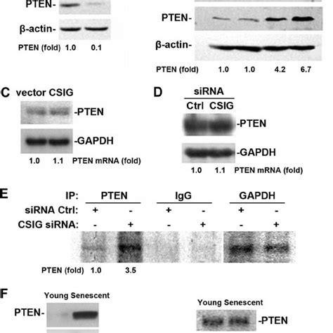 The Tissue Expression Patterns Senescence Associated Expression And