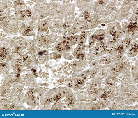 Liver Hepatocyte Lipid Droplets Stock Image Image Of Normal Cells