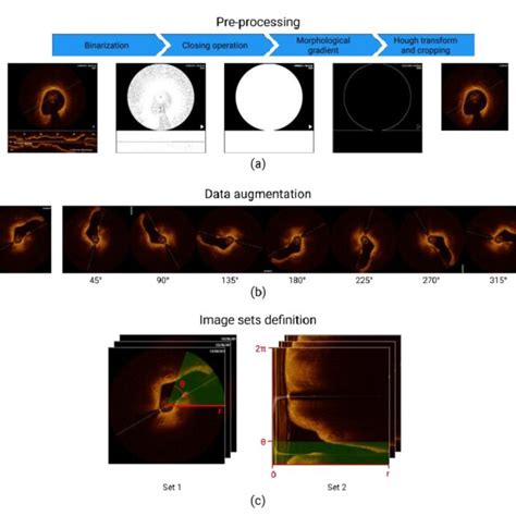 Images Illustrating The Pre Processing Steps A Pre Processing Steps
