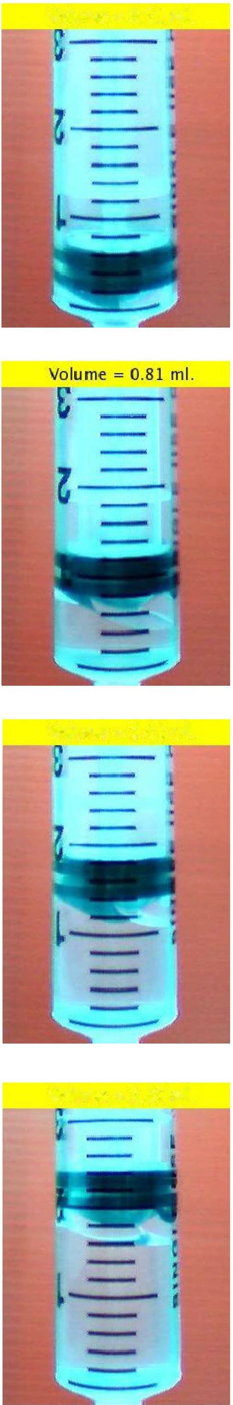 Photographs Of A Ml Syringe That Is Visible For The Operator At Download Scientific Diagram