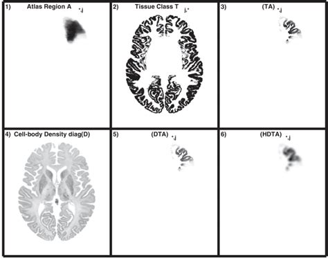 Example Of One Of The Basis Functions J Used In The Forward Projection Download Scientific