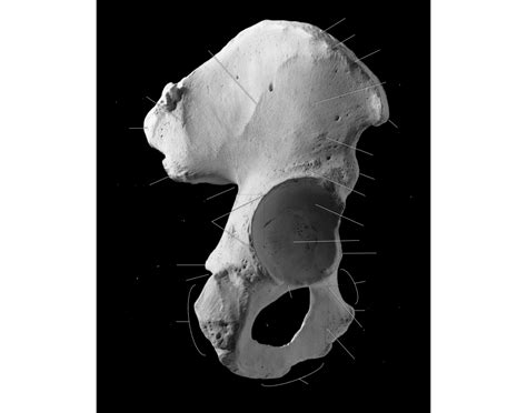 Right Pelvis Lateral View Quiz