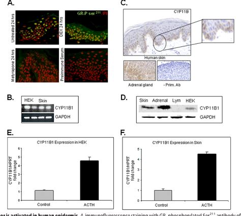 Figure 1 From Cortisol Synthesis In Epidermis Is Induced By Il 1 And