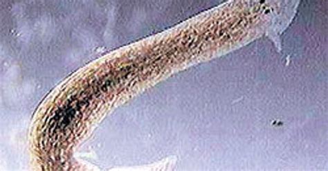 Flatworm Can Provide Clues To Treat Eye Diseases