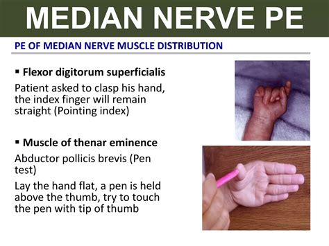 Peripheral Nerve Injuries Pptx