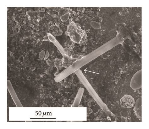 ESEM Micrographs Showing The Diatom Species Composition Present On The