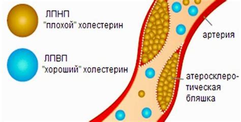 Питание при повышенном холестерине: диета, как понизить холестерин в ...