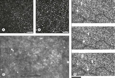 Advanced Imaging Technologies Clinical Gate