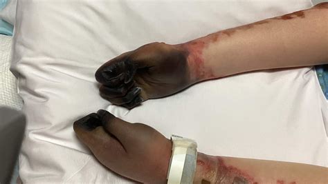 Fundraiser By Kailey Mclaughlin Support Kailey Mclaughlins Journey