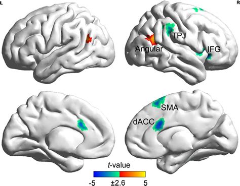 Correlational Patterns Between The Gbc Value And The Verbal Analytic