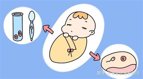 试管婴儿如何决定男女呢？ 知乎
