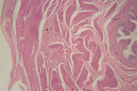 Urinary Bladder Slide Labeled