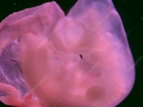 Rat Embryo Light Microscopy Stock Video Clip K0057976 Science