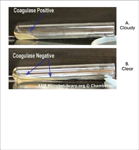 Coagulase Test