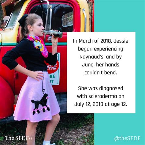 Scleroderma United Added A New Photo Scleroderma United