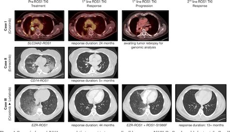 Ntrk Ros1 Inhibitor Ds 6051b Semantic Scholar