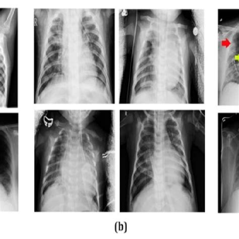 The Block Diagram Of Cnn Architecture A Cnn Model Automatically Learns Download Scientific
