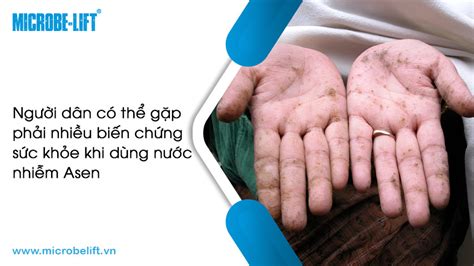 Chất Asen là gì Xử lý nước thải nhiễm Asen Microbe Lift