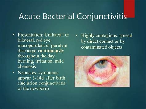 Conjunctivitis 120201025034 Phpapp02 Converted Pptx Infectious