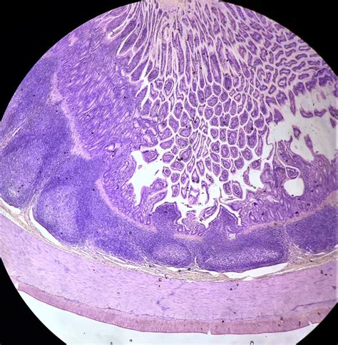 Ileum 100x Diagram Quizlet