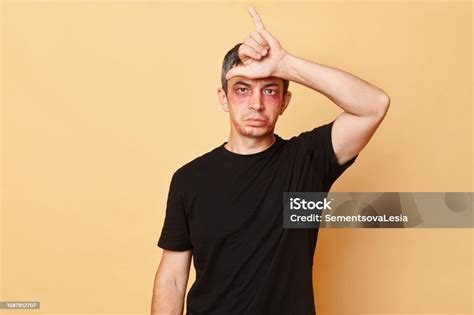 슬픈 절망은 베이지색 배경 위에 고립된 얼굴에 타박상과 찰과상이 있는 검은색 티셔츠를 입은 부상당한 남자가 도둑들에게 구타를 당하고 느슨한 몸짓을 보여줍니다 35 39세에