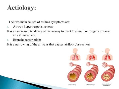 Asthma Pptx