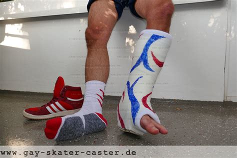 Leg Casts Page 2 The Gay Skater Caster