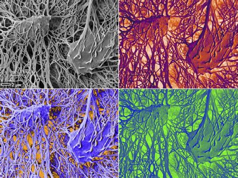Hadi Taghizadeh On Linkedin Osteocytes Network Structure Follows
