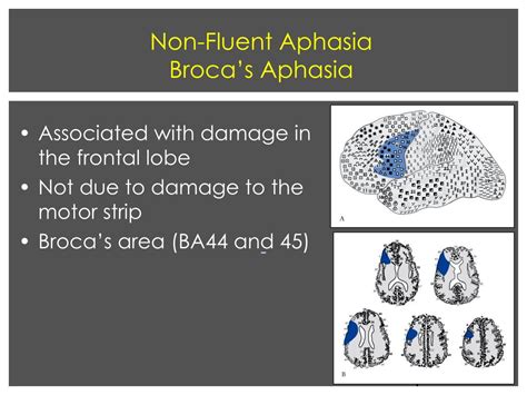 Ppt Language And Aphasias Powerpoint Presentation Free Download Id