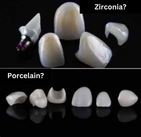 Which Is Better Porcelain Or Zirconia Dental Crown Veneer Turkey