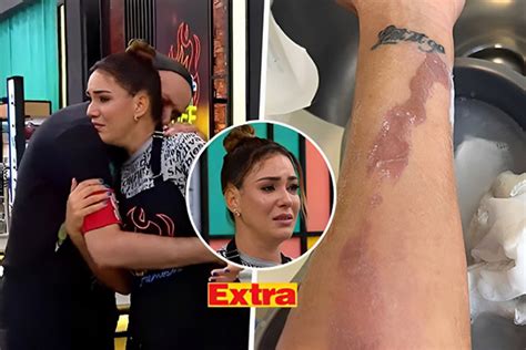 Tilsa Lozano Rompe En Llanto Tras Sufrir Grave Quemadura En El Gran