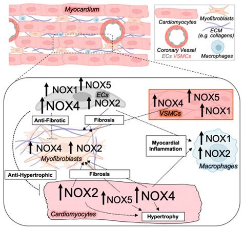Antioxidants Free Full Text Nadph Oxidases In Diastolic Dysfunction