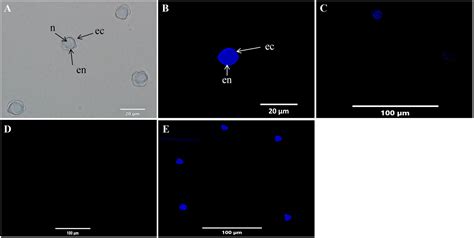 Anti Acanthamoeba Activity Of A Semi Synthetic Mangostin Derivative And
