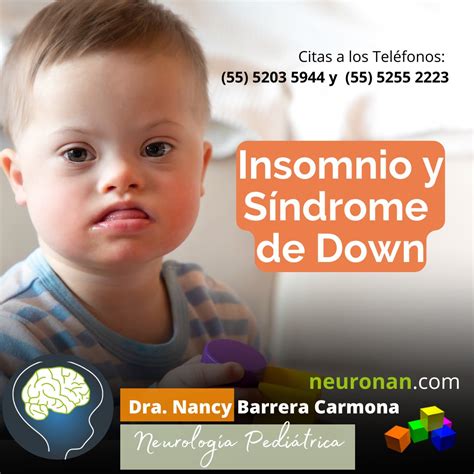 El Síndrome De Down Es Un Dra Nancy Barrera Carmona