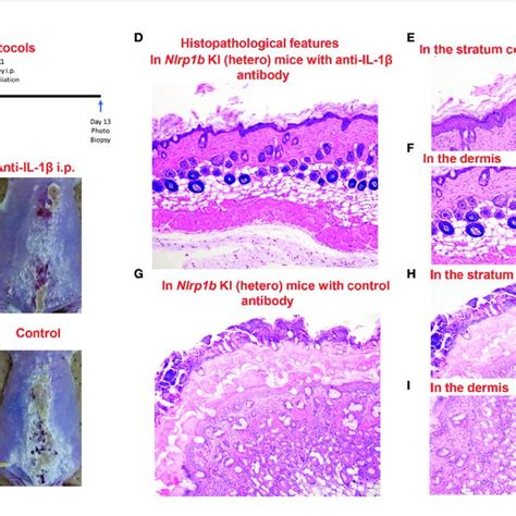 Cutaneous Inflammatory Lesions Induced By Uvb Irradiation In Nlrp1b