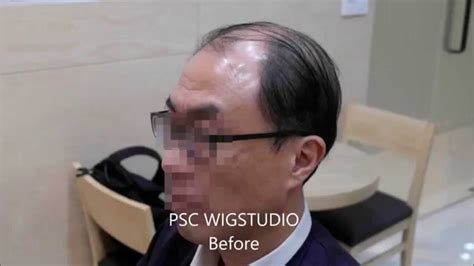 남자부분가발 착용 영상 박승철위그스투디오 인천부평점 Youtube