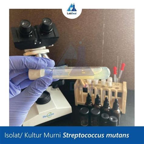 Jual Kultur Mikroorganisme Streptococcus Mutans Dalam Media Agar Di Seller Agavilab Padasuka
