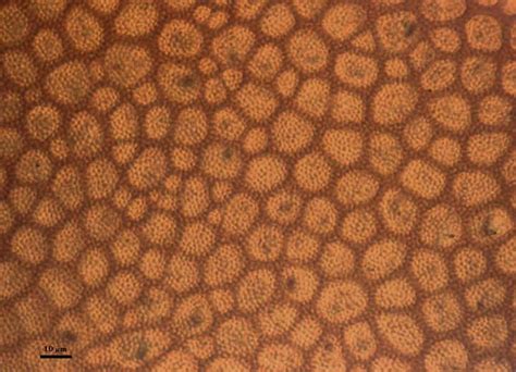 Reticulata INVAM